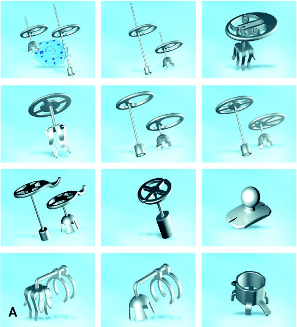 Ossiculoplasty: Indications, Surgery, and Recovery for Better Hearing